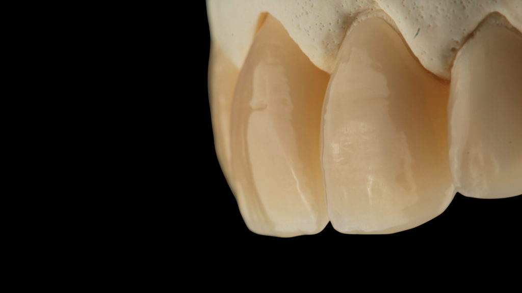 Die stärksten ihrer Art: Grandio blocs und Grandio disc – dental:spiegel