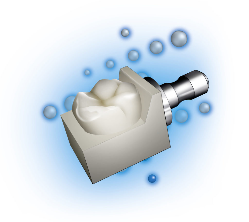 Die stärksten ihrer Art: Grandio blocs und Grandio disc – dental:spiegel